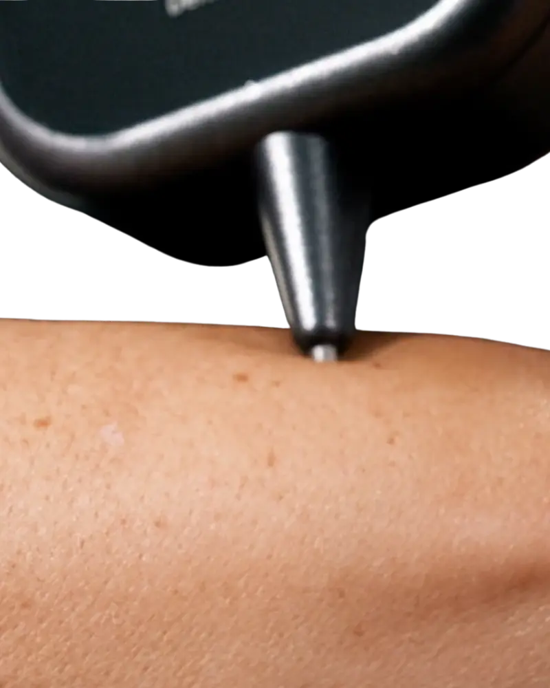 How DermaSensor Works | DermaSensor Technology