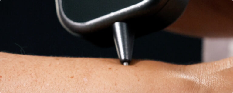 Advanced Skin Cancer & Melanoma Detection Technology | DermaSensor